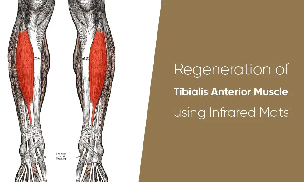 Regeneration of Tibialis Anterior Muscle With Infrared Mat - Infrared ...