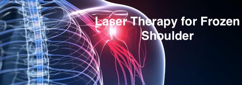 5 Studies: Is Laser Therapy Good For Frozen Shoulder? - Infrared for Health