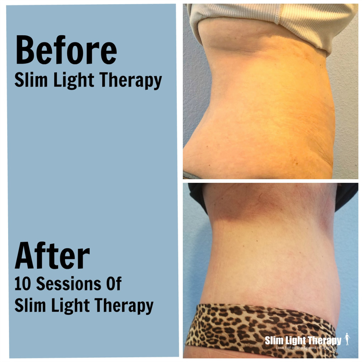 How to Use Red Light Therapy for Fat Loss? - Infrared for Health